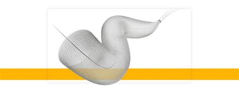 Stryker Rolls Out Surpass Elite® Flow Diverter Across Us South Korea