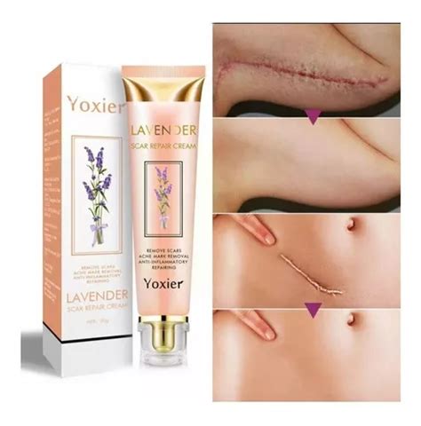 Pomada Creme Yoxier Remove Tira Cicatrize Queloide 20g MercadoLivre