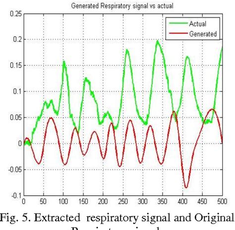 Figure 5 From Extraction Of Respiratory Signal From ECG Using Empirical Mode Decomposition