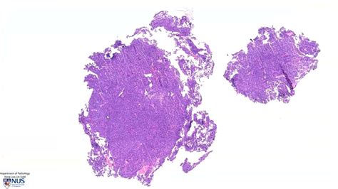Pituitary Gland Slide Id Made Easy Your A Histo Guide