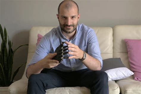 Bionit Labs Con La Mano Bionica Ha Raccolto 5 5 Milioni