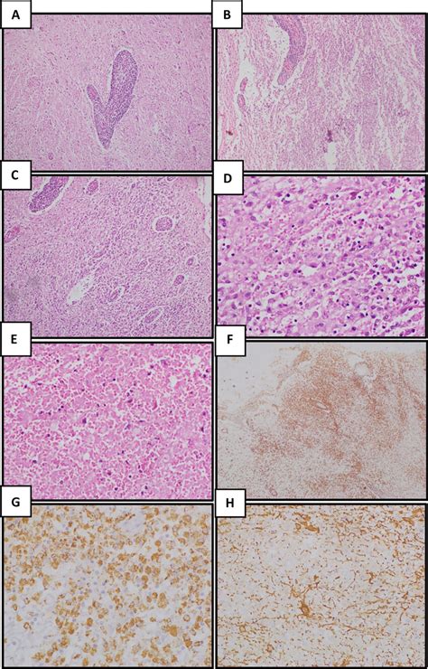 Histopathology Of The Brain A And B Haematoxylin And Eosin Stain