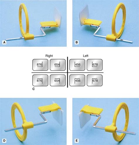 Xcp Dental Placement At Joanne Tindall Blog