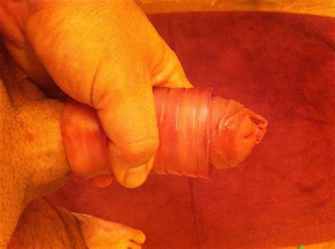 My Uncut Cock Xnxx Adult Forum My Uncut Cock Xnxx Adult Forum