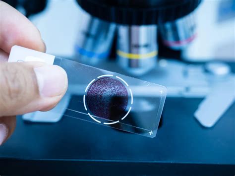 Patient Record Retrieval Stat Informatic Solutions