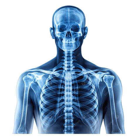 Medical X Ray Scan Of A Human Upper Body Highlighting Skeletal
