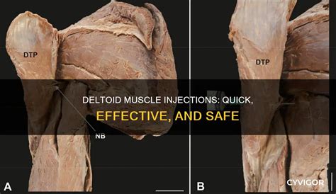 Deltoid Muscle Injections Quick Effective And Safe Cyvigor