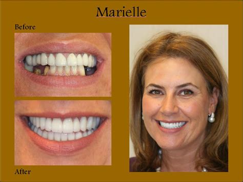 Patient Testimonials Michael S Singleton D D S
