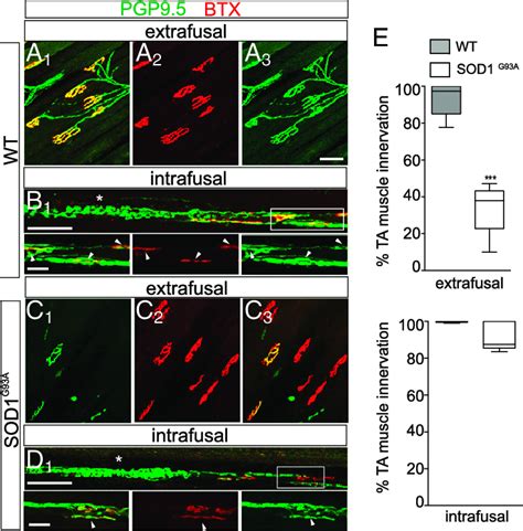 Innervation Of Intrafusal Muscle Fibers Is Preserved In End Stage Sod1 Download Scientific