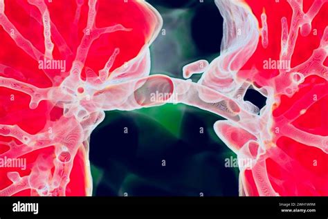 Lungs And Trachea CT Scan Stock Photo Alamy