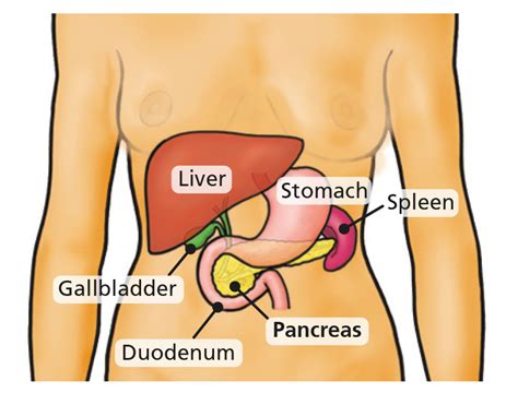 Distal Pancreatectomy An Operation To Remove Part Of Your Pancreas