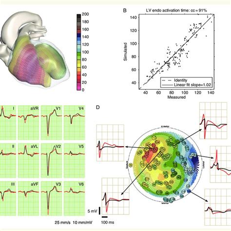 Comparison Of Measured And Simulated Data In Patient 1 A Simulated