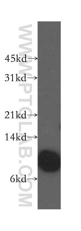 Beta 2 Microglobulin Antibody 13511 1 Ap Proteintech 武汉三鹰生物技术有限公司