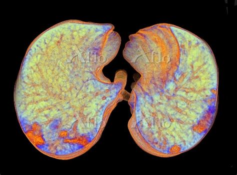 Coloured 3D Computed Tomography CT Scan Axial View Of Human