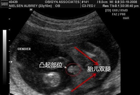 B超看男女准吗b超看男孩有亮点 随意云