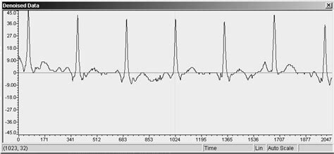 denoising of ecg signal using daubechies wavelet daubechies db4 wavelet