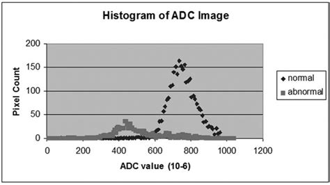 Histogram Of Adc Values In Both Normal Contralateral Brain And A Region