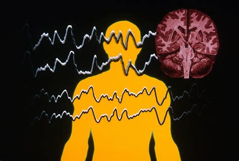 Implantable Brain Device Could Stop Epileptic Seizures In Their Tracks