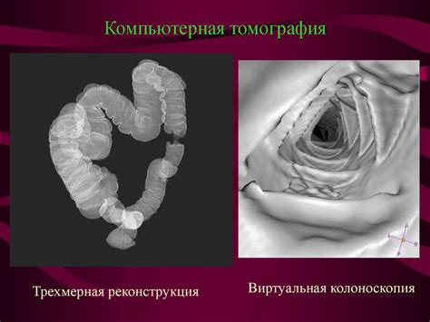 Лучевая диагностика заболеваний органов желудочно кишечного тракта