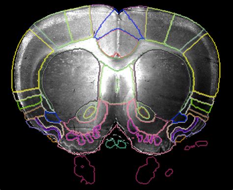 Optimizing A Brainreg Fit Image Analysis Image Sc Forum