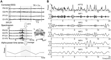 Electroencephalogram Alpha