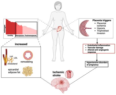 Ischemic Stroke In Women Understanding Sex Specific Risk Factors Treatment Considerations And
