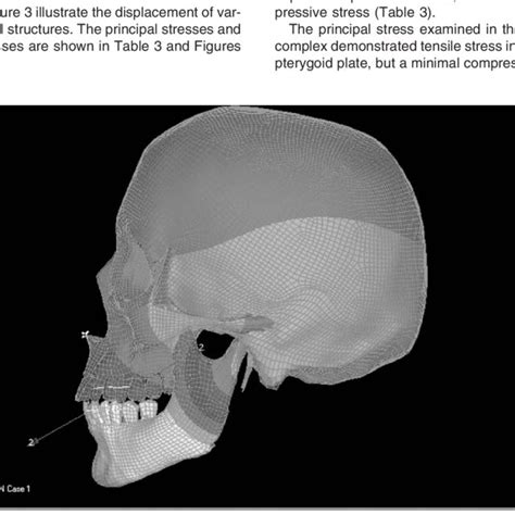 Displacement Of Various Craniofacial Structures In Mm A Download Table