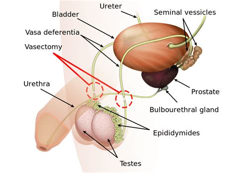Difference Between Castration And Vasectomy Pediaacom