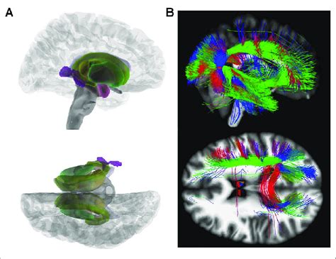 Mean Diffusivity Md A Glass Brain View Of The Difference In Md