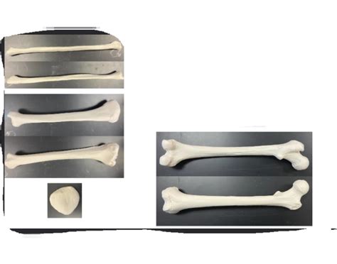 Leg Disarticulated Quiz