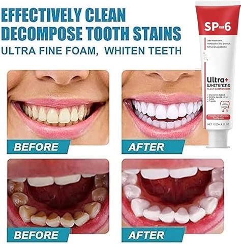 Msdrwikey Sp 6™ Probiotic Whitening Toothpaste Moonqo Store