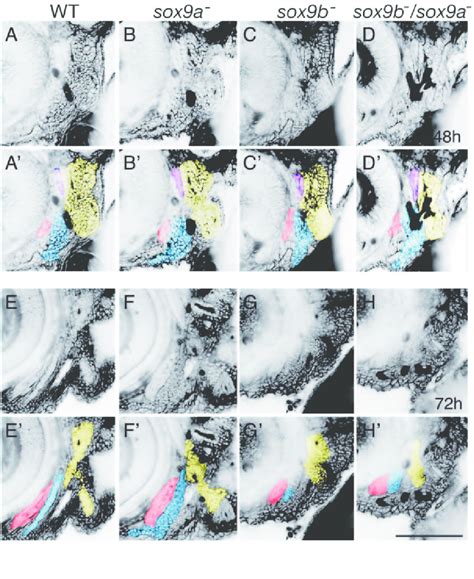 Differential Functions Of Sox9 Duplicate Genes In The Morphogenesis And