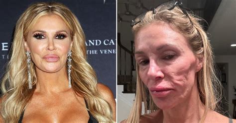 Brandi Glanville Blames Parasite For Dramatic Change In Appearance