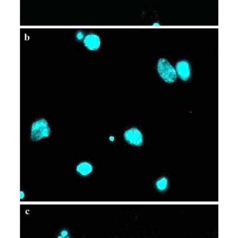 Analysis Of Nuclear Fragmentation By Dapi Staining Dapi Staining Was Download Scientific