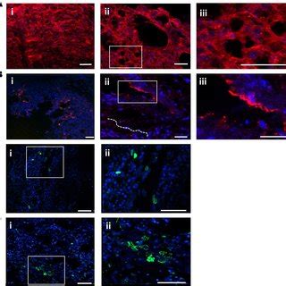PCLS Cytoskeleton Structure Under Different Media Conditions PCLS