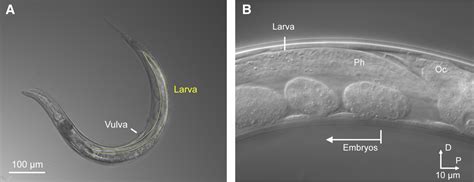 New Worm Species With Three Sexes And Pouch Like Kangaroos Found In California