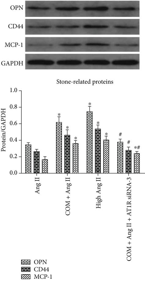 Caox Induced Ros Generation And Overproduction Of Stone Related