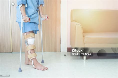 환자는 목발의료 개념에 아시아 여성의 무릎에 후방 십자 인대 수술 붕대 후 병원 도자기 무릎 중괄호 지원에 목발과 함께 걸어하려고합니다 가정의 방에 대한 스톡 사진 및 기타