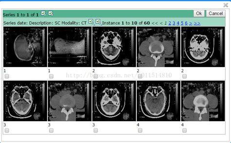 Dcm4cheearchiveservicewadoservice Is Not Registeredjava 实现 Wado Csdn博客 Dcm4cheearchiveservicewadoservice Is Not Registeredjava 实现 Wado Csdn博客