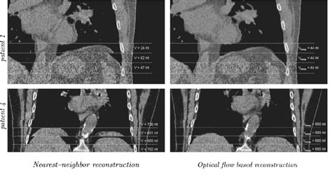 Figure 2 From An Optical Flow Based Method For Improved Reconstruction
