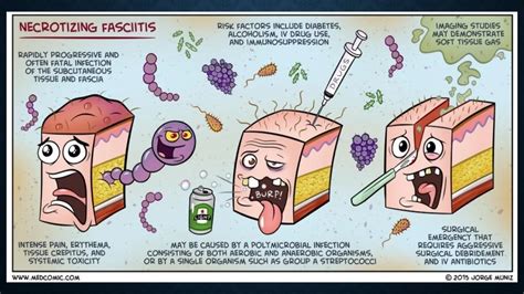 Necrotizing Soft Tissue Infection Vs Cellulitis Ppt