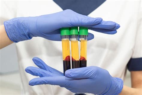 What Are Platelets And How Can They Help Your Injury Heal Katz