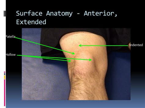Ppt Knee Evaluation Powerpoint Presentation Free Download Id2139935