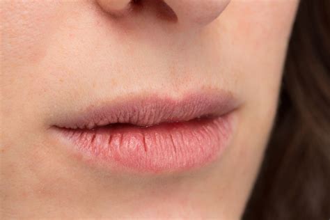 4 Productos Para Aliviar Los Labios Partidos Y Restaurarlos En Pocas
