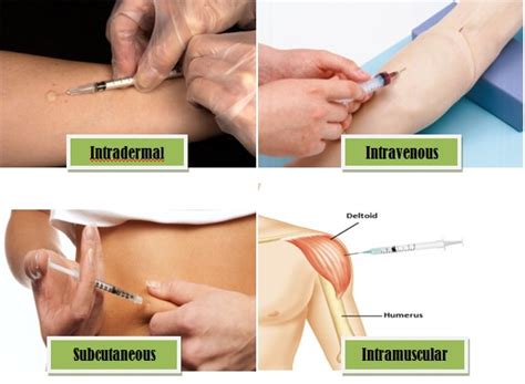 Subcutaneous Injection Sites Names