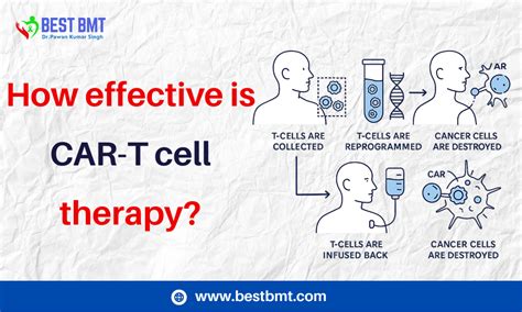 How Effective Is Car T Cell Therapy