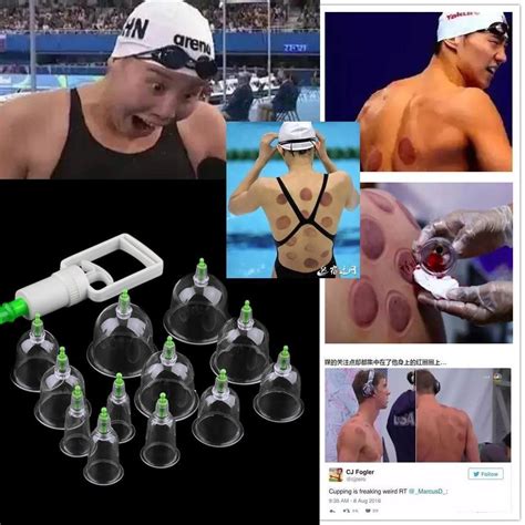 Effective Healthy 12 Cups Medical Vacuum Cupping Suction Therapy Device