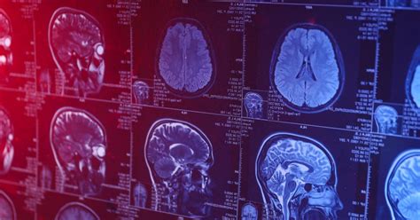 New Algorithm Promises To Revolutionize Cancer Detection Dh Arab