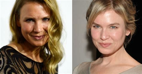 ¿a Qué Se Debe El Cambio De Renée Zellweger Ella Lo Explica