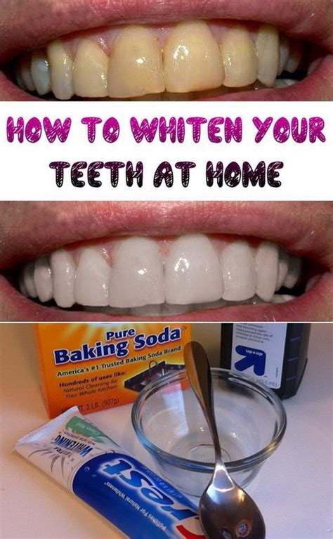 Best Teeth Whitening Kit Artofit